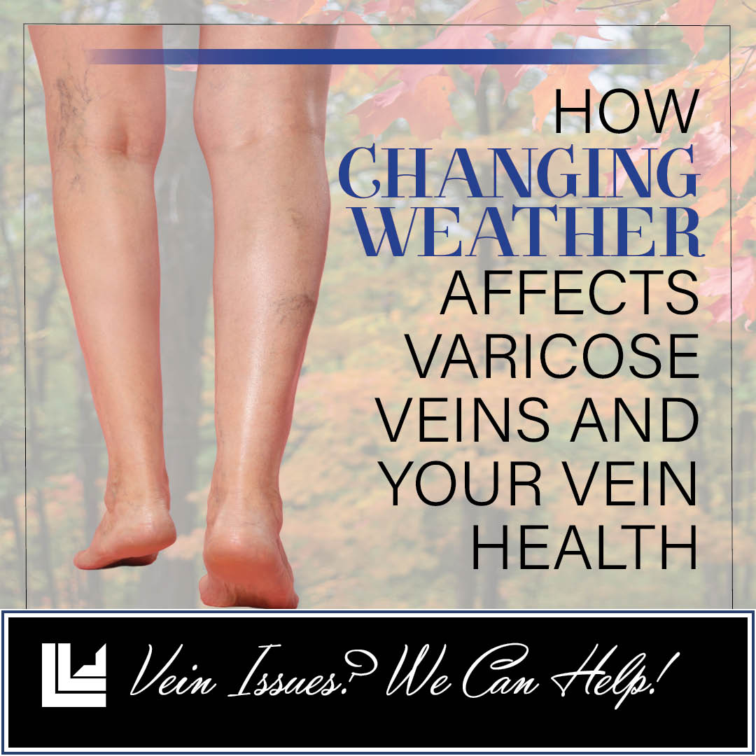 How Changing Weather Affects Varicose Veins and Your Vein Health - St ...